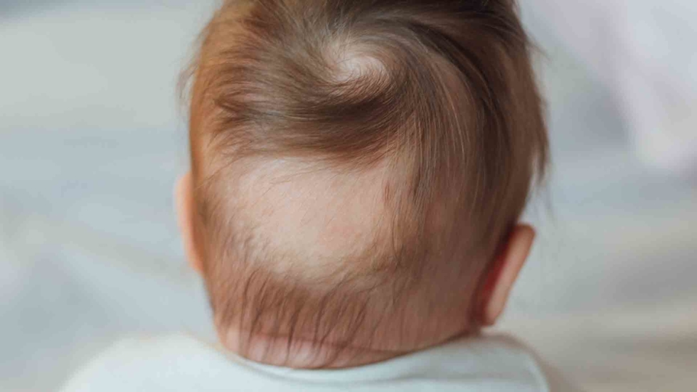 Penyebab dan Cara Mengatasi Rambut Bayi Tipis dan Jarang!