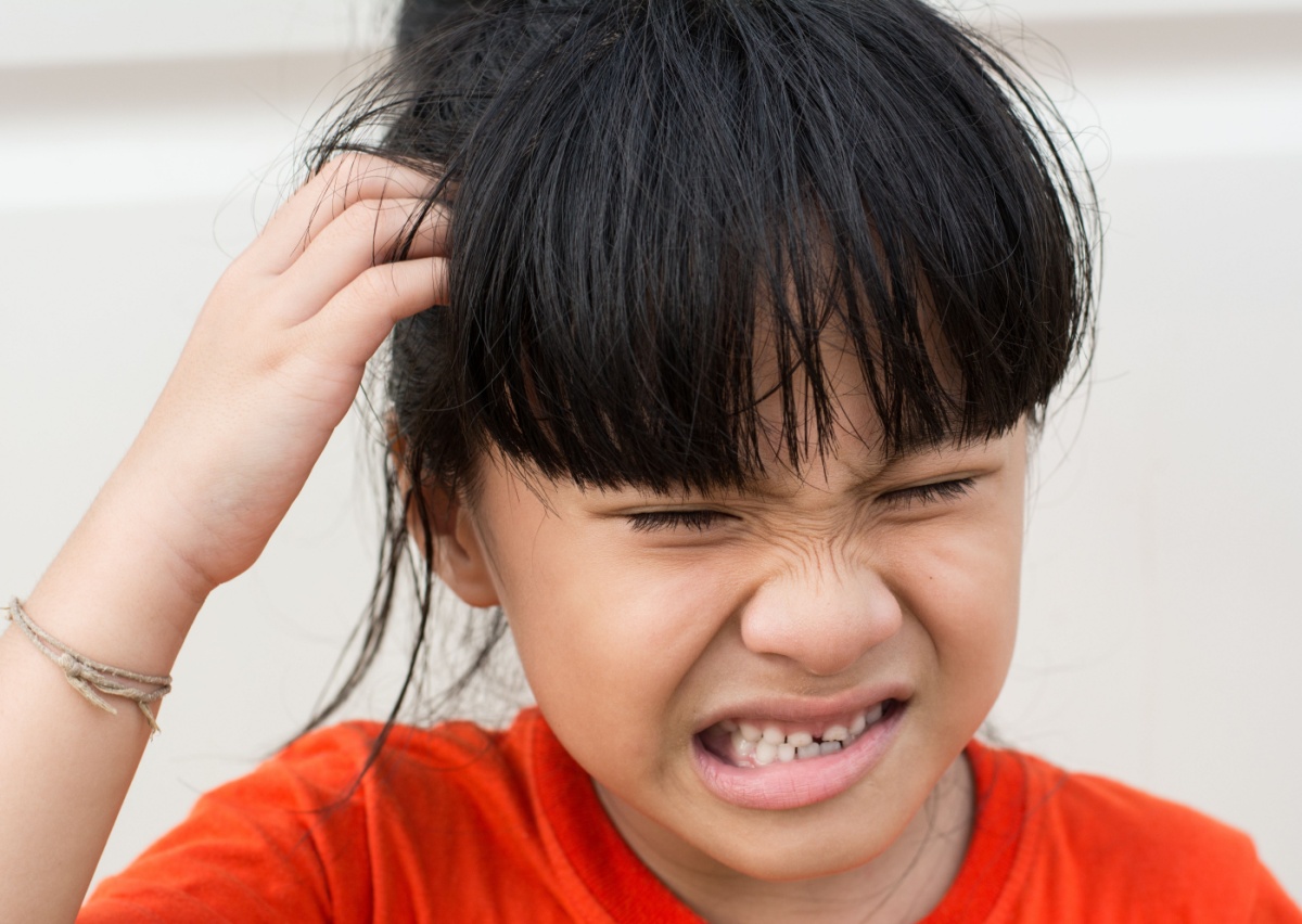 Ini Penyebab dan Cara Mencegah Kutu Rambut pada Anak